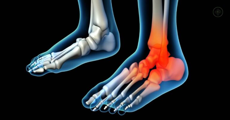 Víme Proč Vás Bolí Chodidla & 9 Způsobů Jak Se Bolesti Zbavit